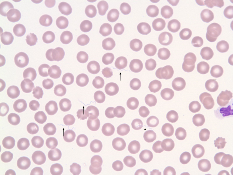 Tick-Borne Relapsing Fever - Texas A&M Veterinary Medical Diagnostic ...