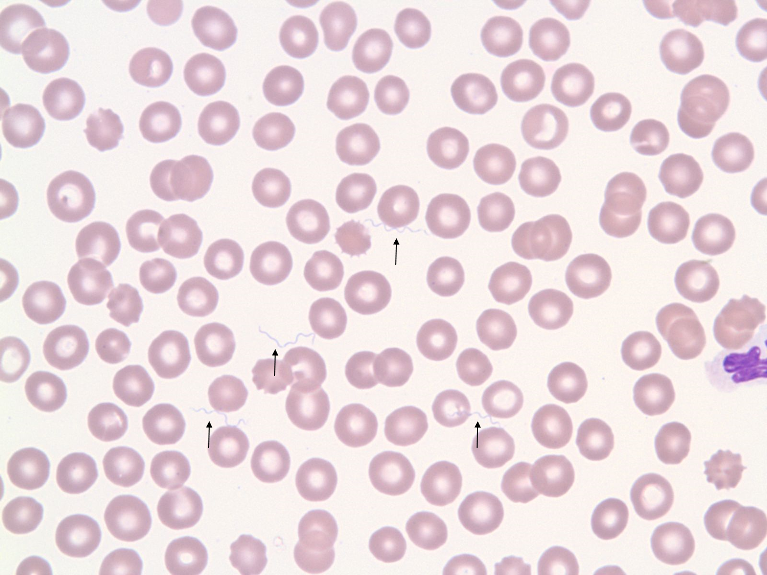 Tick-Borne Relapsing Fever - Texas A&M Veterinary Medical Diagnostic ...