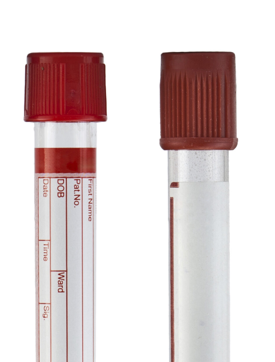 Tube Reference Chart - Texas A&M Veterinary Medical Diagnostic Laboratory